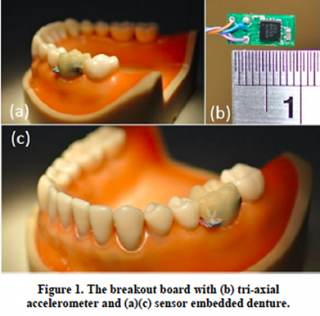 Monitor Your Mouth with a Bluetooth Tooth - Artigo - News - Brasil ...